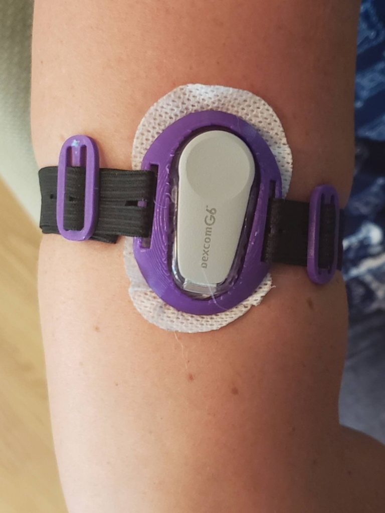How to Make Your CGM and Insulin Pump Sites Stick
